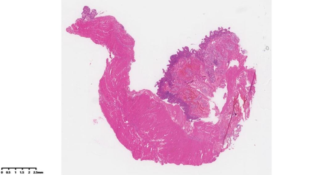 Over 600 000 Slides These Slides From The Pathology Center Are Special